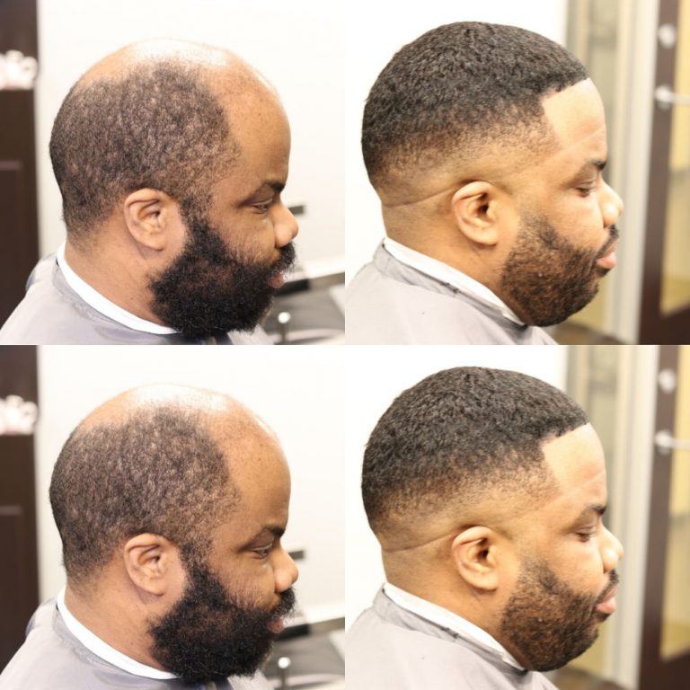 custom_hair_unit_after_4 - Bevans Grooming - Barbershop Houston Texas